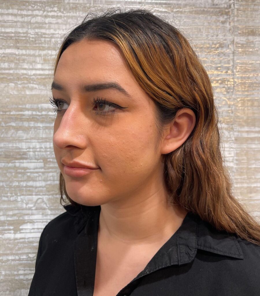 Rhinoplasty in Houston | Nose Surgery | Heights Plastic Surgery